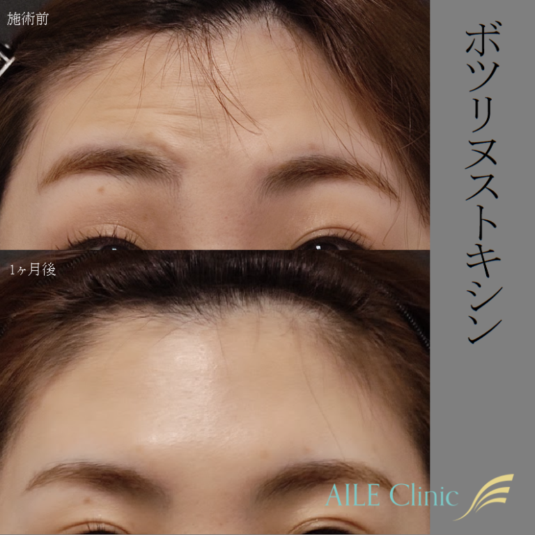 症例写真 | エールクリニック | AILE Clinic