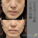 症例写真 | エールクリニック | AILE Clinic