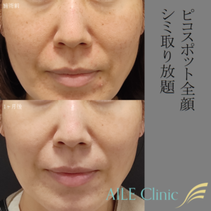 症例写真 | エールクリニック | AILE Clinic
